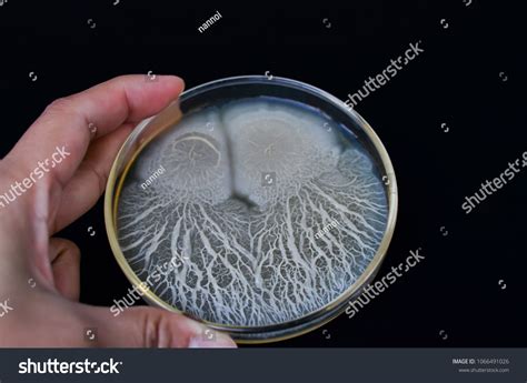Beautiful Bacterial Colonies Bacillus Sp Growing Foto De Stock
