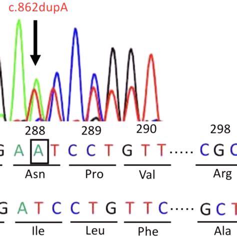 Gnas Mutation The Patients Sequence Analysis Showed A Heterozygous Download Scientific