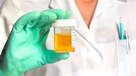 More Employees Are Cheating On Workplace Drug Tests Heres How They Do It Cbs News