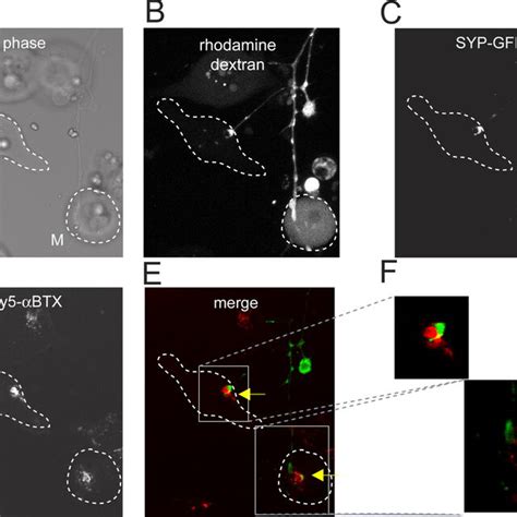 Synaptic Sites Are Revealed By Double Labeling With Syp Gfp And