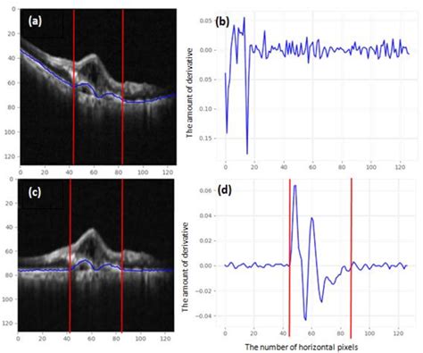 Ac The Sample Image Before And After Alignment Bd Plot Of