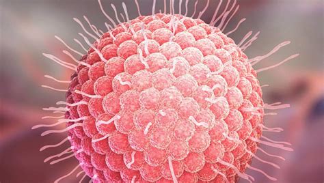 ჰერპეს ზოსტერი სარტყლისებრი ჰერპესი Synevo