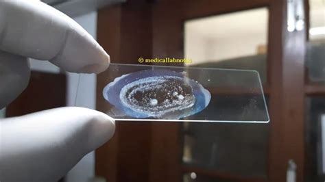 Staphylococcus Vs Micrococcus Introduction Differentiating Features Keynotes And Related