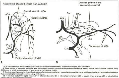 Distal Medial Striate Artery Semantic Scholar