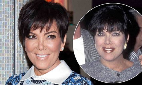 Kris Kardashian Plastic Surgery Before And After
