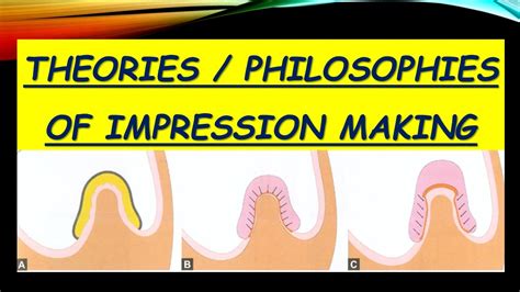 Complete Denture Impression Materials At Sally Seim Blog