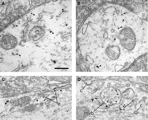 Localization Of Ha Dat Within Dendrites Electron Micrographs From Download Scientific Diagram