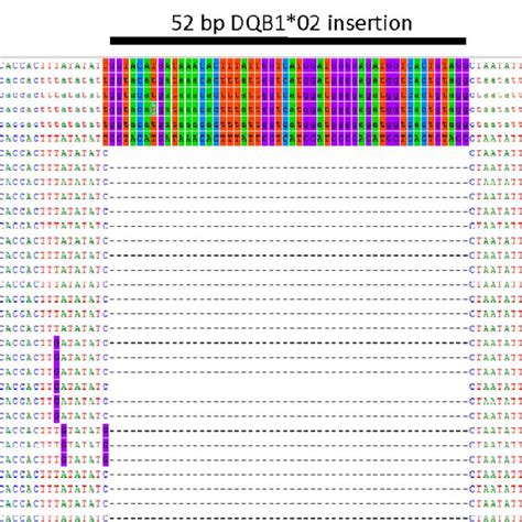 sequence alignment of dqb1 alleles showing the 52 bp insertion unique
