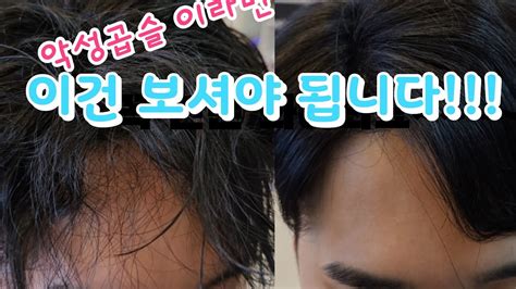 악성곱슬머리 진짜 자연스러운 볼륨매직 하였습니다 Youtube