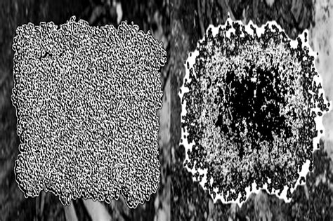 Pathological Menace Prods Acute Cholangitis Secondary To A Clogged