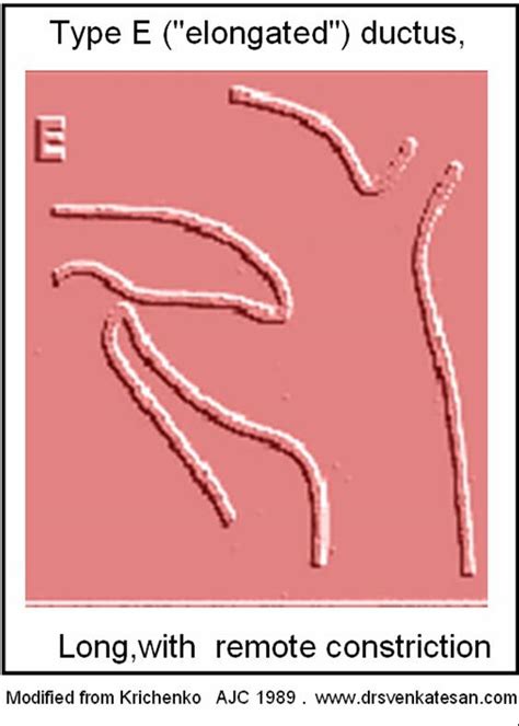 2mm Pda Drsvenkatesan Md