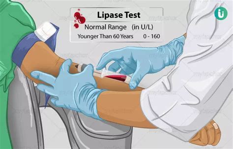 Lipase Meaning Serum Lipase Test In Hindi Normal Range Cost High