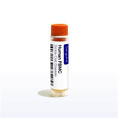 High Quality Pbmc Samples For Sickle Cell Disease Pbmc Research
