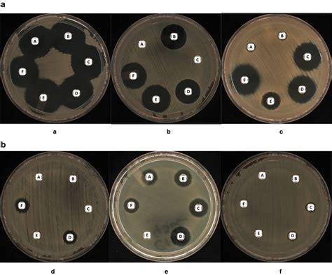 Sensitive Strain A No Difference Between The Different Disks Esbl
