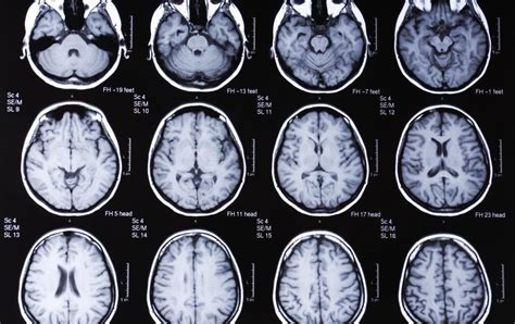 ai มาเอง จัดการลบ noise ให้ภาพใสกิ๊งด้วย “noise2noise” ชัดแจ๋วยันภาพถ่ายอวกาศ unlockmen