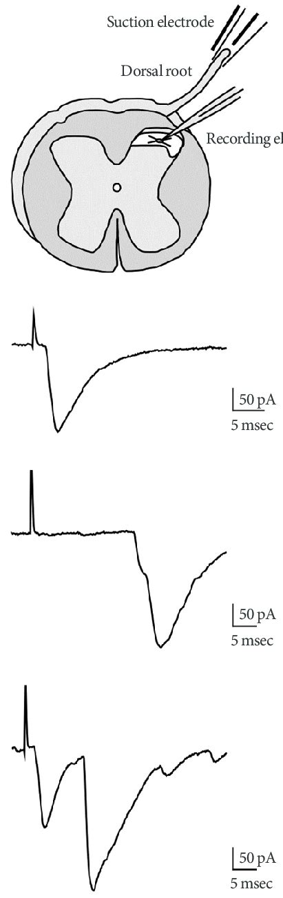 Various Patterns Of Excitatory Postsynaptic Currents Epscs Elicited