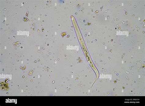 Sample Under Microscope At Claire Fahey Blog