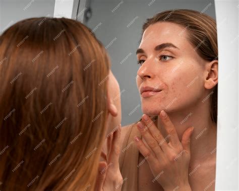 Premium Photo Portrait Of Person With Dermatitis Skin Condition