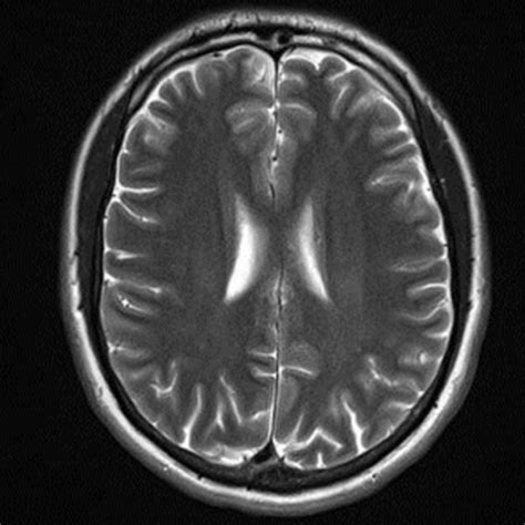 Cjd The Caretaker Fan Projects Wiki