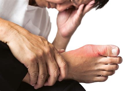 Arthritis Foundation Of Wa Scleroderma