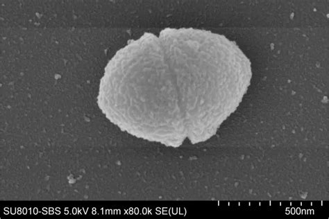 Bacteria Commonly Found In The Body Contribute To Stomach Cancer Finds Study News The