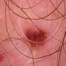 Github Siddharthrajpal Healthvision This Project Uses Deep Learning Algorithms And The Keras