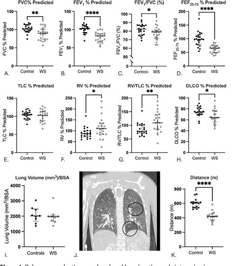 Figure 1 From Airflow Obstruction In Adults With Williams Syndrome And