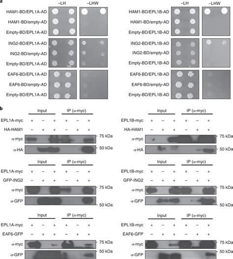 Arabidopsis Epl1 Proteins Directly Interact With Nua4 Piccolo Download Scientific Diagram