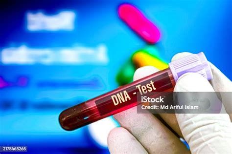 의료 실험실에서 Dna 검사를 위한 혈액 샘플 Dna에 대한 스톡 사진 및 기타 이미지 Dna Dna 테스트 Stem 주제 Istock