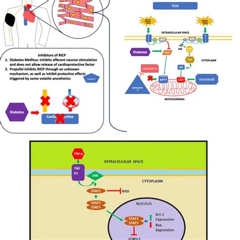 This Figure Depicts Points Along The Remote Ischemic Preconditioning
