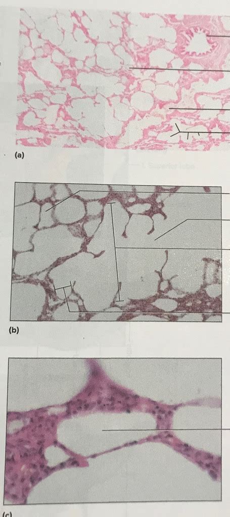 Lung Microscope Slides Diagram Quizlet