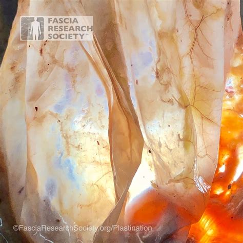 Fascial Net Plastination Project 🍃 Reflections From The Lab Your Heart Is Made To Be Light