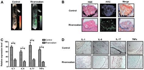 Rivaroxaban Attenuates Thrombosis By Targeting The Nf κb Signaling Pathway In A Rat Model Of