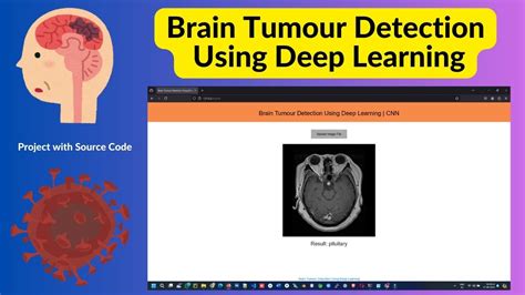 Brain Tumour Detection Project Using Deep Learning From Mri Image Projectworlds