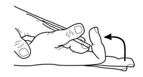 7 Physical Therapy Finger Exercises After Injury Fort Worth Hand Center