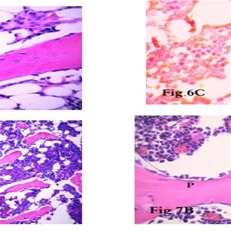 A A Photomicrograph Of A Longitudinal Section Of Rat Proximal Tibia Download Scientific