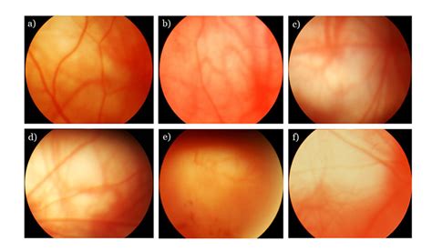 Fundus Photographs Of Rat Retinas A A Normal Fundus From Wistar Rat Download Scientific