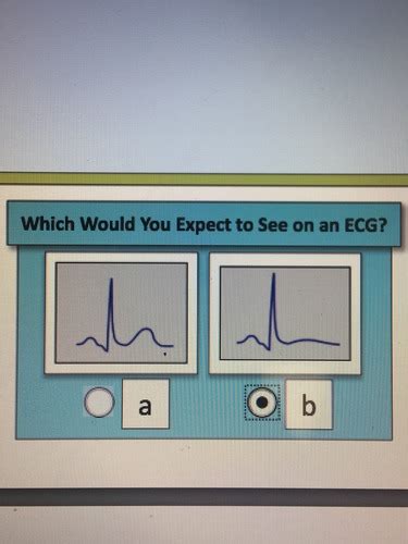 Hyper And Hypothyroidism Concept Map Flashcards Quizlet Hyper And Hypothyroidism Concept Map Flashcards Quizlet