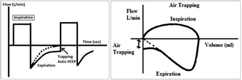 Diagnosis And Management Of Auto Peep In Obstructive Pulmonary Disease Ccm Daily