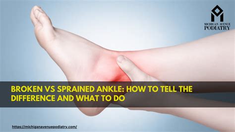 Exercises To Treat An Inversion Sprain Of Ankle