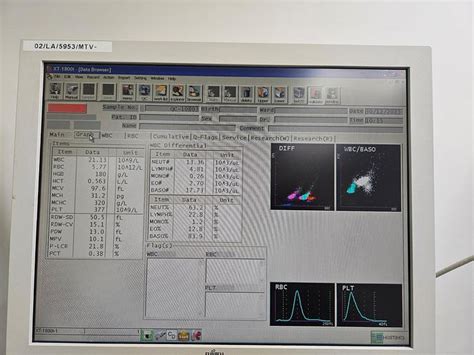 Sysmex Xt 1800i Automated Hematology Analyzer