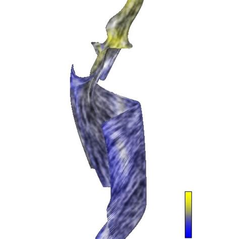 Texture Advection On Stream Surfaces A Novel Hybrid Visualization