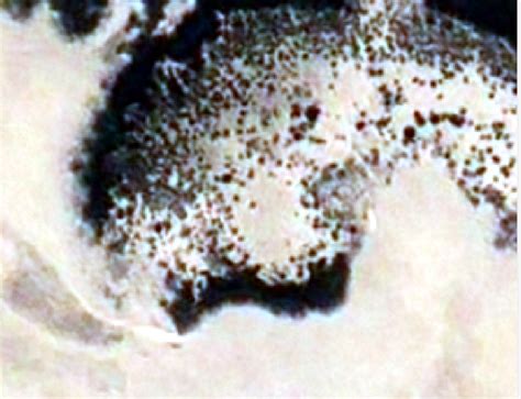 Image Registration Otb Usage Orfeo Toolbox Forum