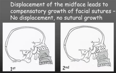 603 Maxillary Growth 7 Flashcards Quizlet