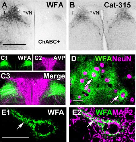 Ecm Structures In The Pefah A Wfa Green And Neun Magenta Download Scientific Diagram