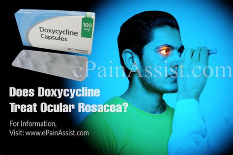 Does Doxycycline Treat Ocular Rosacea And How Long Does It Take To Work