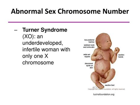 Ppt Chromosomes And Human Inheritance Patterns Of Inheritance Powerpoint Presentation Id