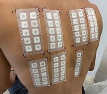 Patch Testing Lincoln Road Dermatology