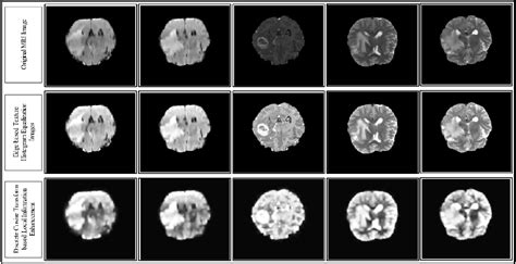 Figure 1 From Multimodal Brain Tumor Classification Using Deep Learning