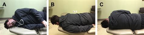 Benign Paroxysmal Positional Vertigo Physician Assistant Clinics
